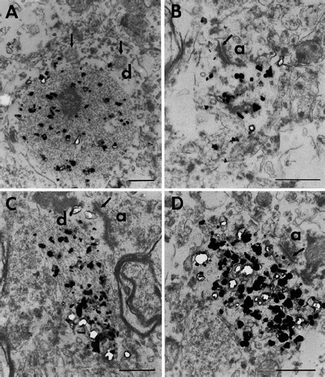 Neuropil Aggregates In Dendritic Profiles Electron Micrographs Of Em48