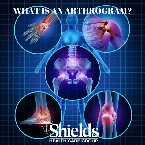 What Is An Arthrogram