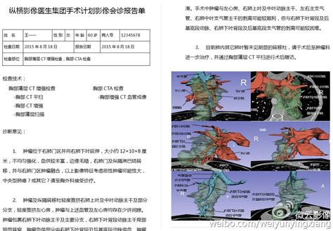 3d打印、vr、手术计划共同进驻微至云动云影像平台 by 微至云动云影像 极速 专业的互联网医疗影像浏览器 ，html5 dicom