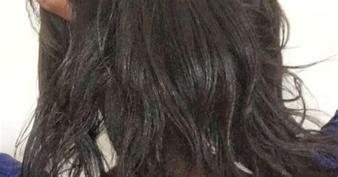 Tips For Combating A Dry And Flaky Scalp A Relaxed Gal