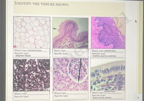 Solved Identify The Tissues Shown Major Type Co Specific