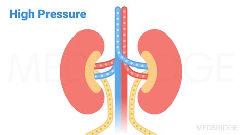 Sci Bowel Bladder And Sexual Dysfunction Medbridge