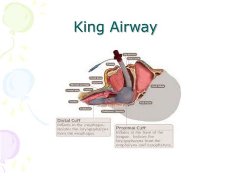 Ppt Airway Ventilation And Shock Powerpoint Presentation Free