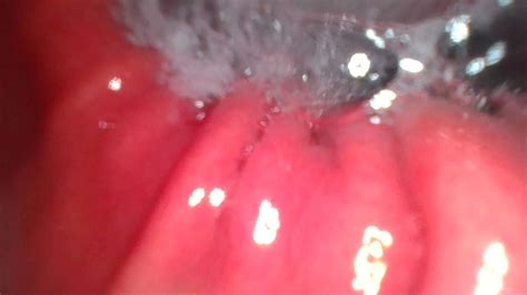 Empty Stomach Twitching