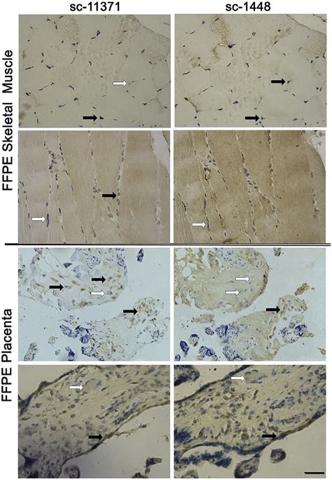 Protein Expression Of 1 Nachr Subunit Using Two Different Antibodies In
