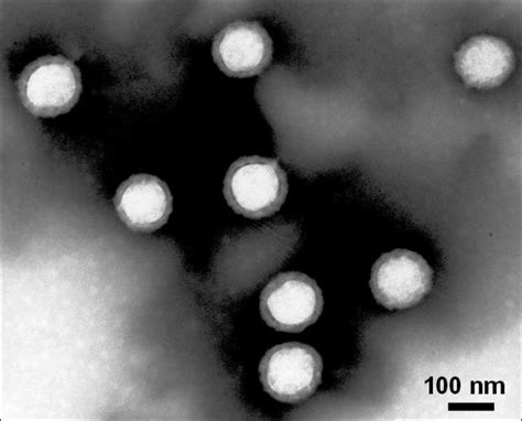 Fig S1 Tem Image Of Core Shell Nanospheres Prepared From Recipe 2 The