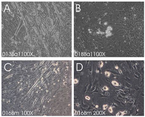 Non Induced Msc Differentiation In Primary Culture Aorta Primary