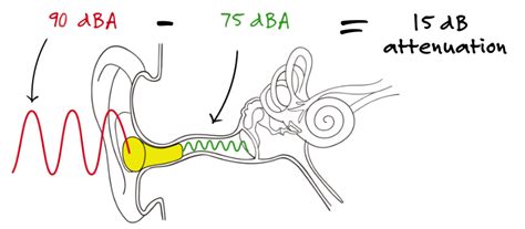 Strategies Sect 3 Pg4 Attenuation Dangerous Decibels Online Educator Training