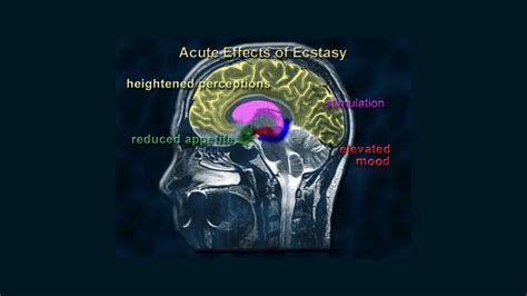 Ecstasy Effects On Brain