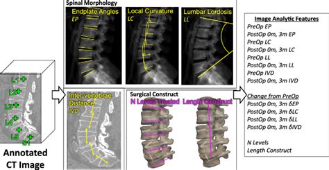 Calculation Of Automatic Image Analytics From Spine Ct At Preoperative Download Scientific