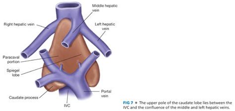 Segmental Hepatectomy Abdominal Key