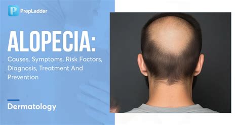 Alopecia Risk Factors Alopecia Areata Fact Sheets Yale Medicine