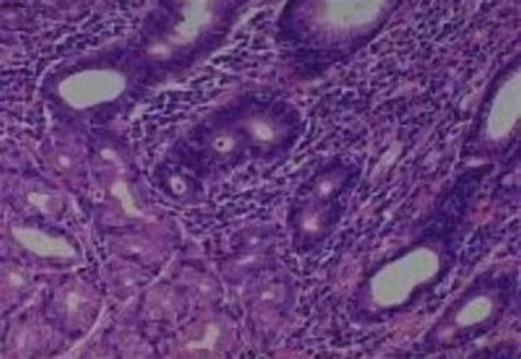 Novus Biologicals Human Multi Tissue Tissue Microarray Cancer Human Ovary Fisher Scientific Novus Biologicals Human Multi Tissue Tissue Microarray Cancer Human Ovary Fisher Scientific