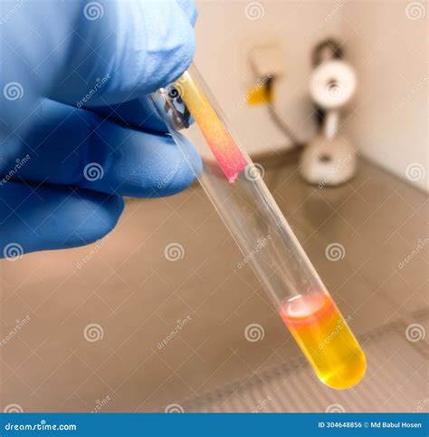 Salmonella Detection Method By Using Triple Sugar Iron Tsi Agar In Microbiology Laboratory