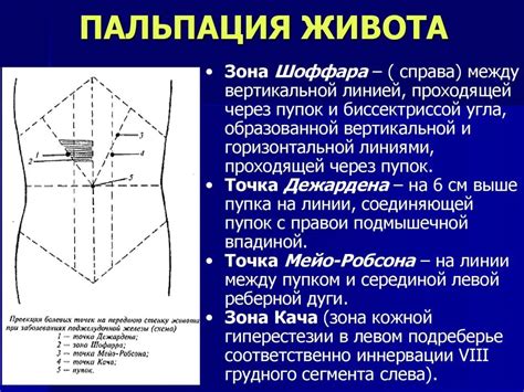 91. Пальпация живота, симптомы, выявляемые при заболевании ...