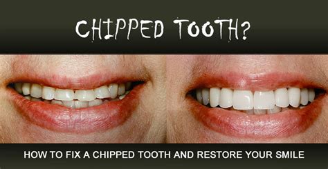 How To Fix Chipped Teeth Dentist Norcross And Alpharetta Ga