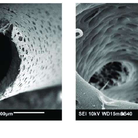 Pdf Physical Processes In Polymeric Filters Used For Dialysis