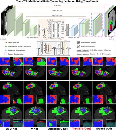 [r] Transbts Multimodal Brain Tumor Segmentation Using Transformer R Computervision