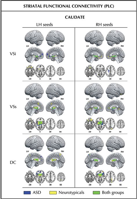 Baseline Striatal Caudate Functional Connectivity Within Each
