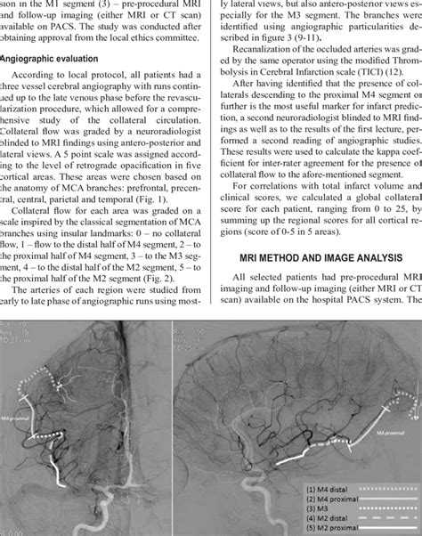 Collateral Fl Ow Grading System Antero Posterior And Lateral