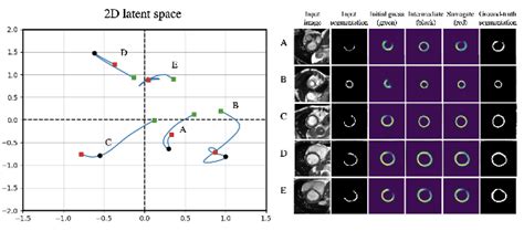 Pdf Deep Generative Model Based Quality Control For Cardiac Mri Segmentation 2020 Shuo