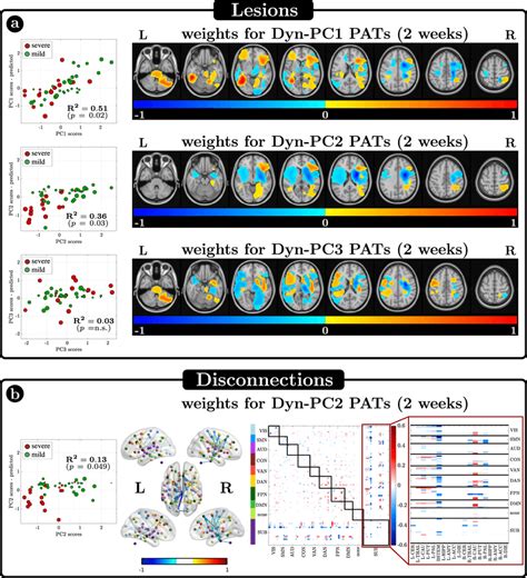 Relationship Between Dynamic Principal Components Dyn Pcs And Lesions Download Scientific