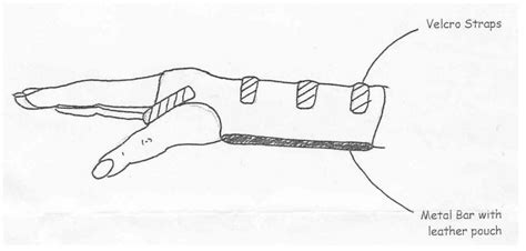 How To Wear Your Wrist Splint Milton Keynes University Hospital