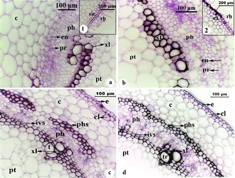 Anatomical Features Of Stressed And Unstressed Soybean Root And Stem