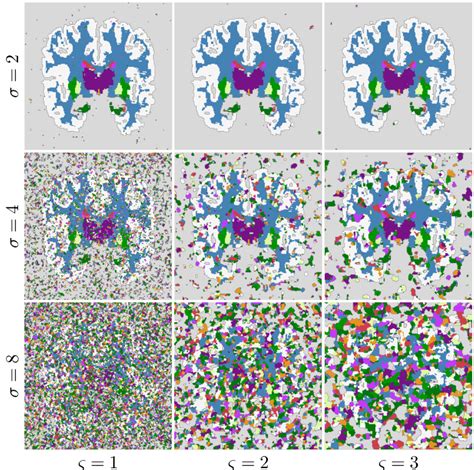 Segmentation Example Corrupted With Gaussian Noise Of Varying Standard Download Scientific