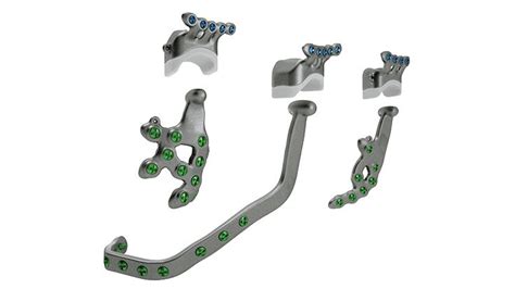 Kls Martin Ips Implants® Tmj Prosthesis