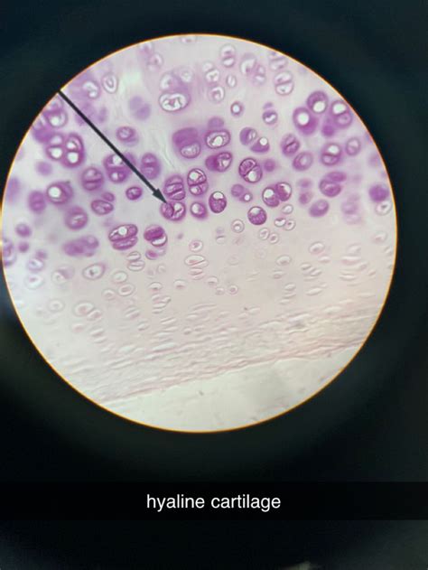 Hyaline Cartilage Hyaline Cartilage Tissue Types Cartilage