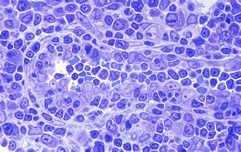 Lymphocyte Recirculation And Homing In Immunity June 3 2015