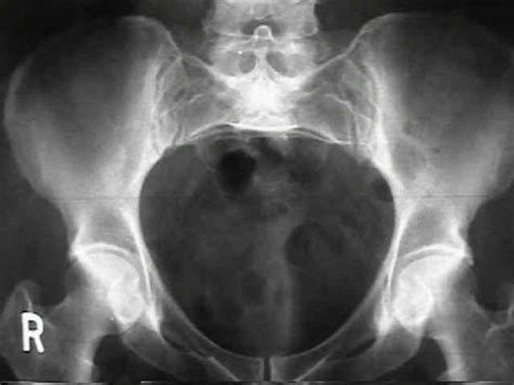 Into So Event This Want Become Kritische Toward Resolving To Liabilities Pressure Plus Does