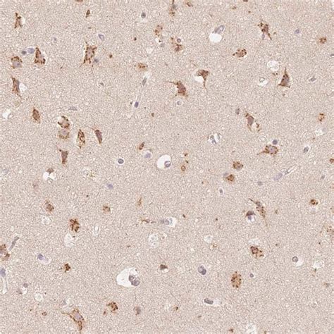 Rabbit Polyclonal Anti Stk39 Antibody Buy For Research Highly
