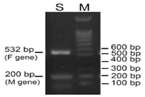 Simultaneous Amplification By Single Multiplex Rt Pcr Of M Gene Ai Download Scientific Diagram