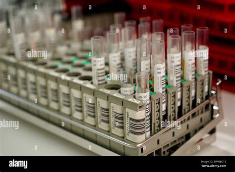 Technical Platform Of The Inovie 34 Laboratory Preanalytical Tubes In Racks On The Sorter