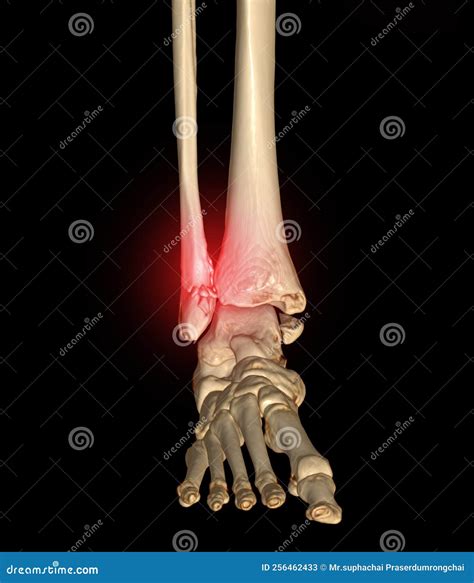 Ct Scan Ankle And Foot Stock Illustration Illustration Of Health