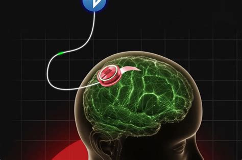 The First Neuralink Brain Implant Signals A New Phase For Human