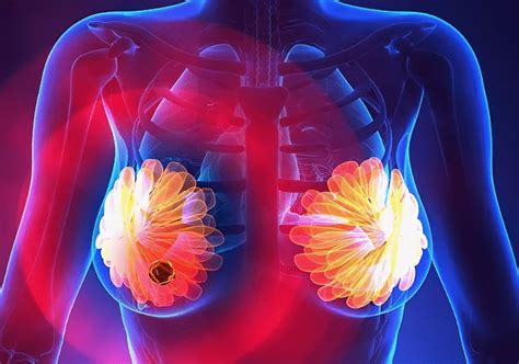 【pnas】“复旦四分型”再完善！邵志敏教授团队绘制最毒乳腺癌“肿瘤特异性转录本”图谱 研究 阴性 治疗