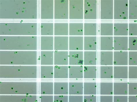 Detecting Yeast Cells Opencv Qanda Forum
