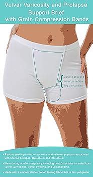 Vulvar Varicosities Support