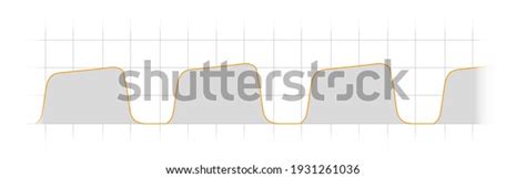 Capnography Waveform Monitoring Normal Curve Stock Illustration 1931261036 Shutterstock