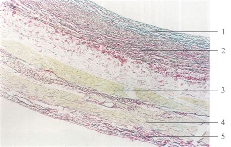 图5 6 心肌袖组织切片 心脏的临床应用解剖学