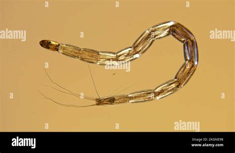 Larva Biting Midges Of Under A Microscope Stock Video Footage Alamy