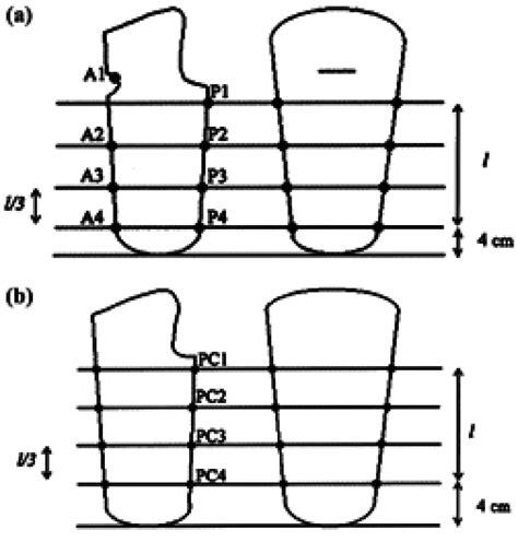 A Placement Sites Of Pressure Transducers On Ptb Socket At Posterior