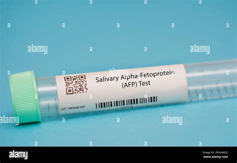 Salivary Alpha Fetoprotein AFP Test This Test Measures The Levels Of AFP A Protein That Is