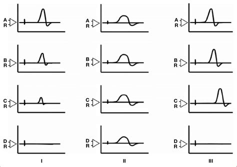4 Spatiotemporal Characteristics Of Signals Recording The Signal Download Scientific Diagram
