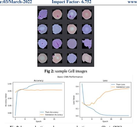 Figure 2 From Malaria Disease Detection Using Deep Learning Semantic Scholar