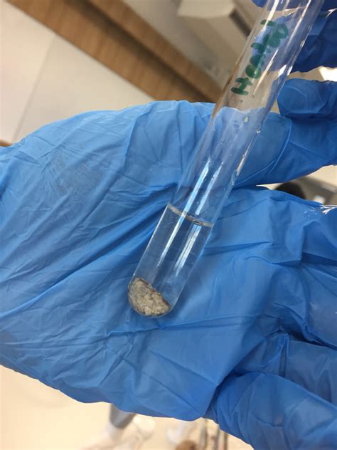 Liver Lab Mr Poramin