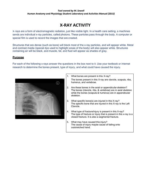 Solution X Ray Identification Activity Studypool